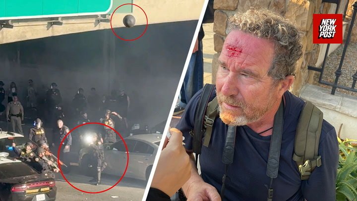 Photographer shot in forehead with rubber bullet while covering LA ...